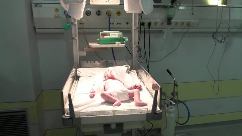 Kyiv hospital treats sick orphans evacuated from northeastern Ukraine ...