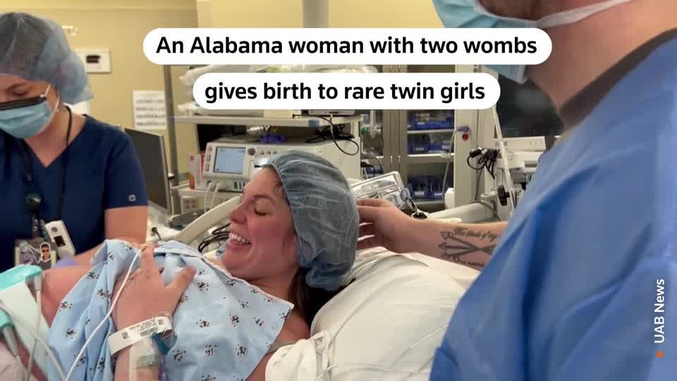Woman with double womb gives birth to rare twin girls