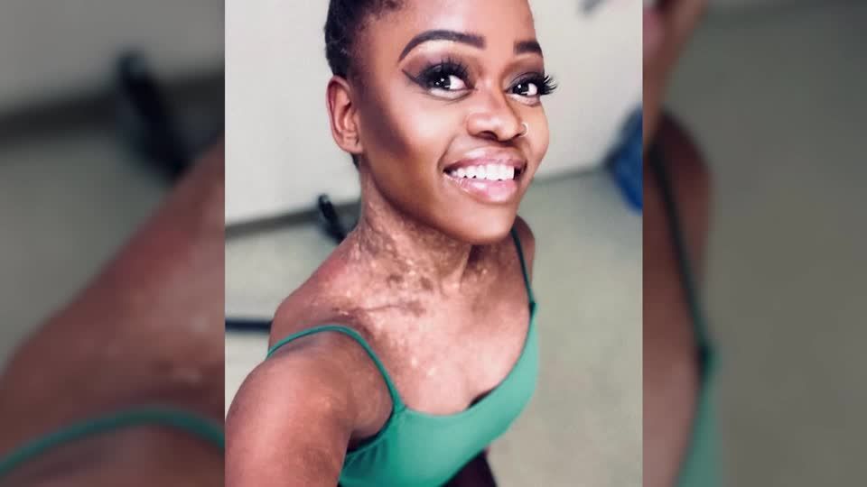 Michaela DePrince, who went from orphan to ballerina, dies at 29 | Reuters