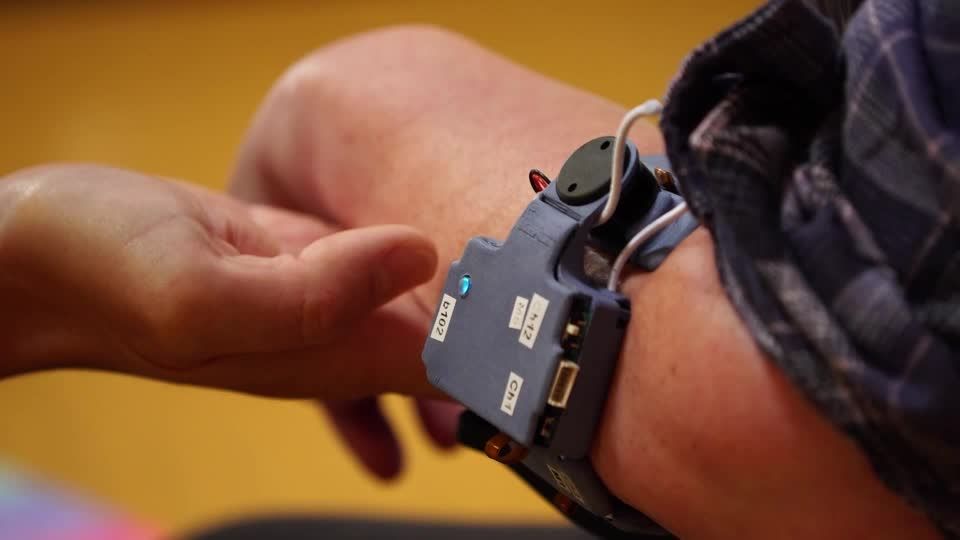 New rehab device aims to 'rewire' stroke patients' brains