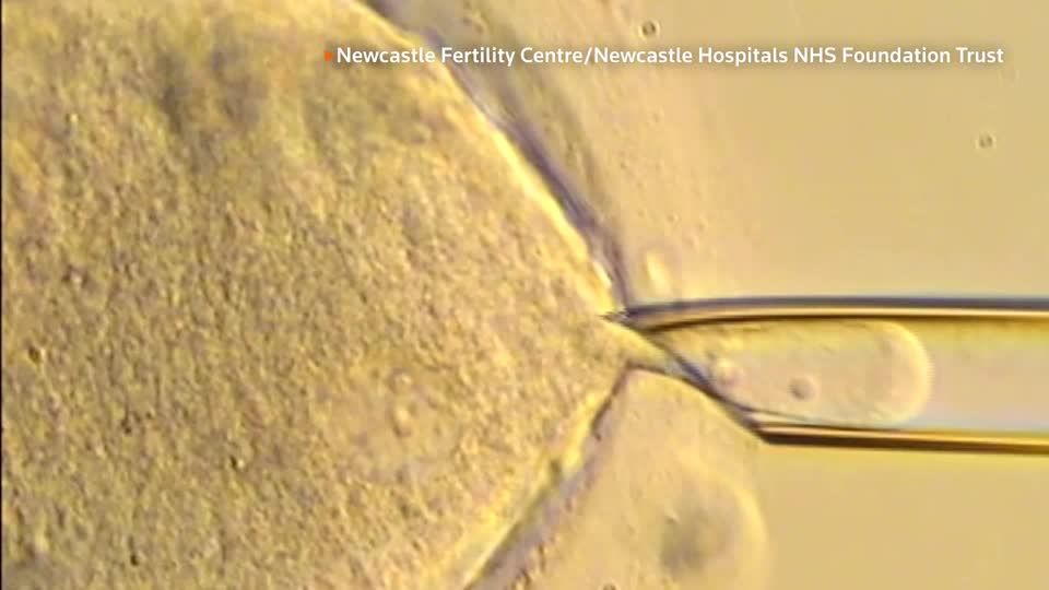 Three-person IVF technique prevents inherited diseases, scientists say ...